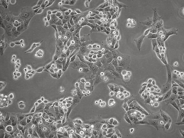 HCC95 Human Lung Squamous Carcinoma Cell Line | SCC483